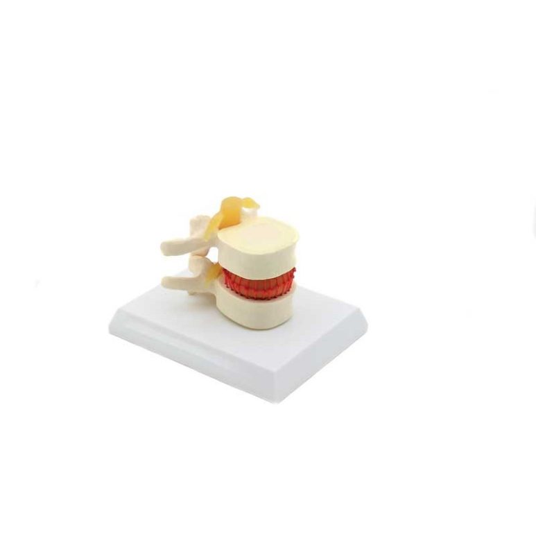 GD1501 Simulatore delle discopatie vertebrali – OPTIKASCIENCE